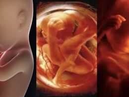 Guía de Primeros Auxilios Básicos - Conecta Salud